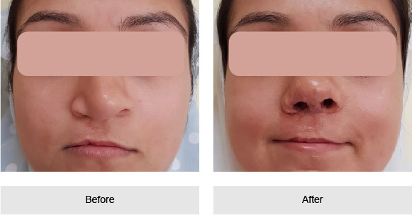 Dr A Mistry's Clinic - Aesthetic Surgery