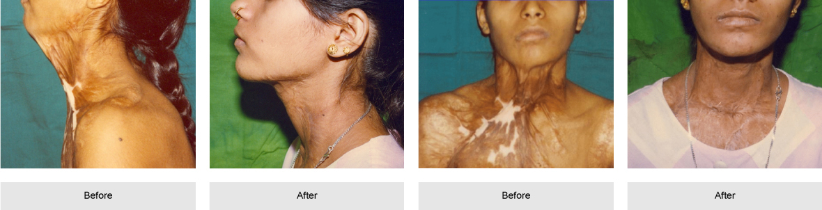 Dr A Mistry's Clinic - Burns